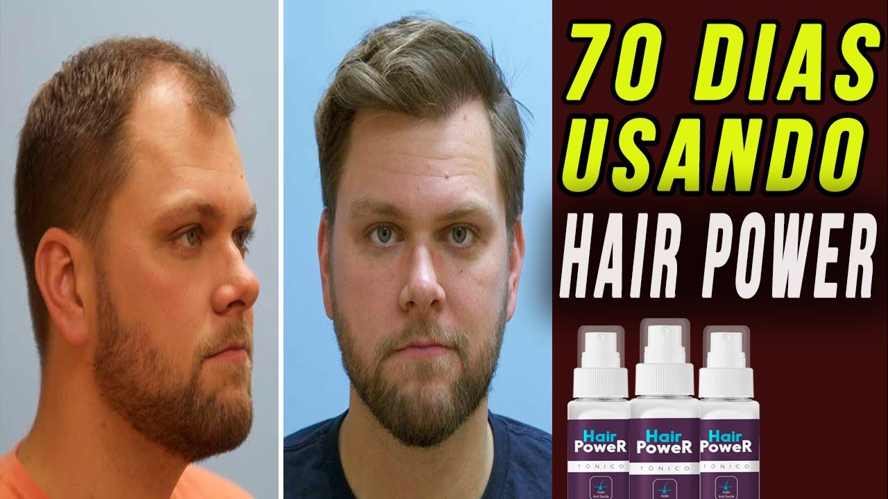 Hair power funciona hair power funciona mesmo- Hair power tonico- Hair ...