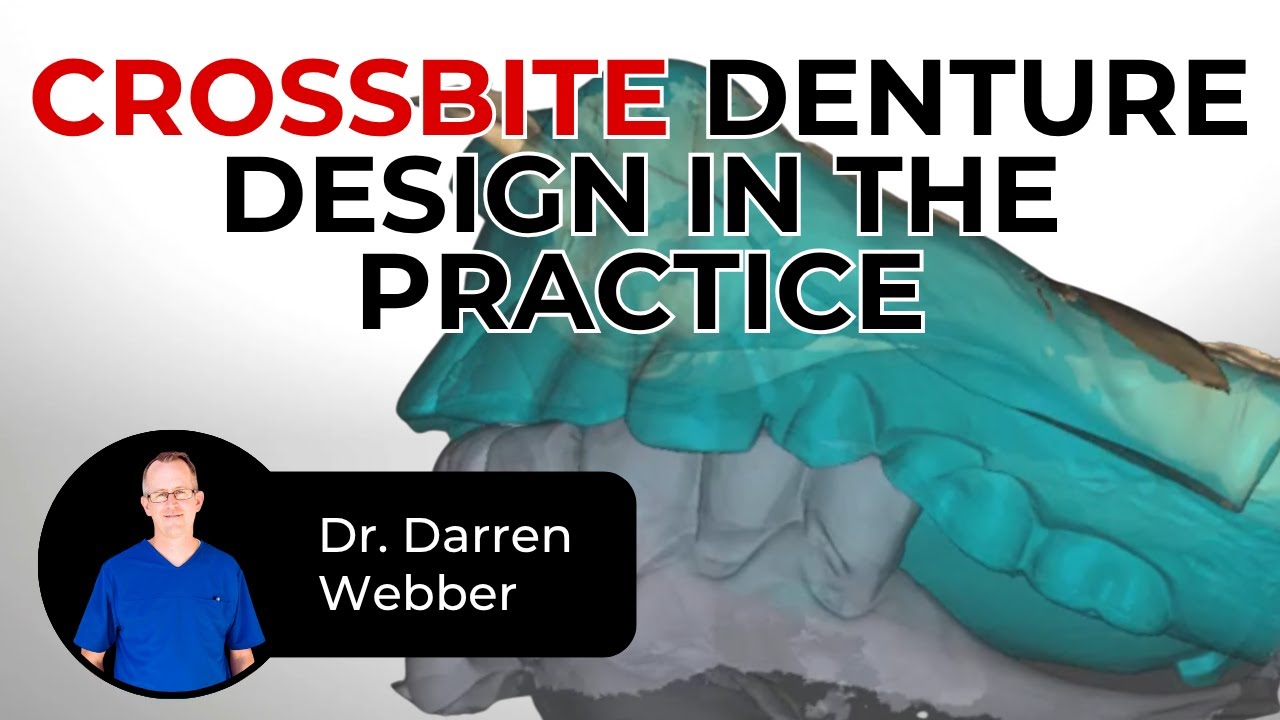 Crossbite Denture Design in exocad with Dr. Darren Webber - ep 0045 ...