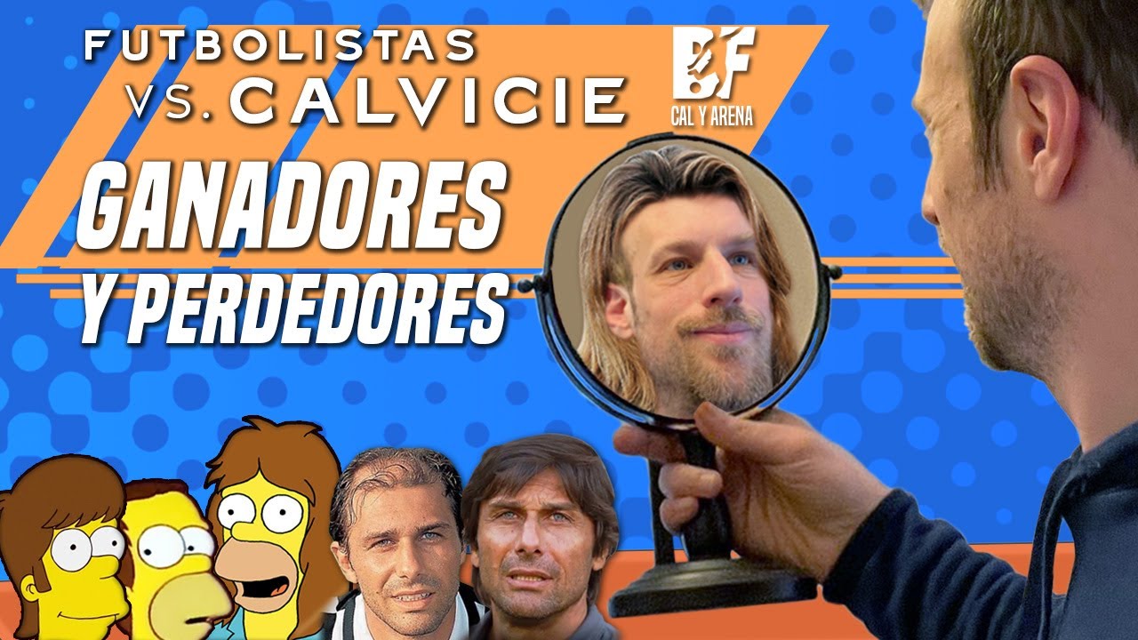 Futbolistas que DERROTARON LA Calvicie... Y otros que se resignaron ...