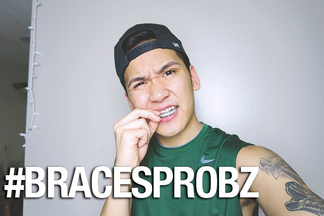 Annoying Braces Problems! (Ft. Whitening Pro System) - YouTube