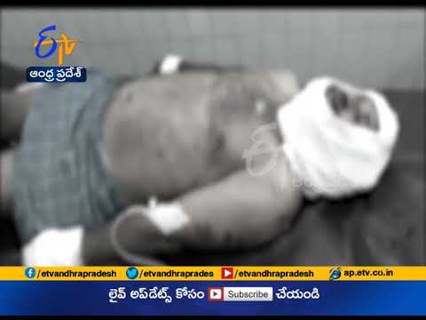 Wife and Husband Killed | Seven Others Injured in a Bear Attack | in ...