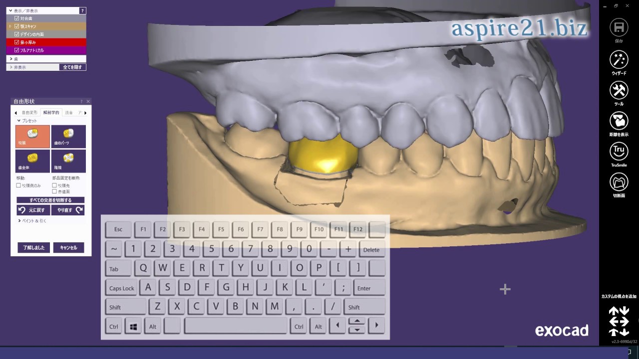 exo shortcut 1 - YouTube