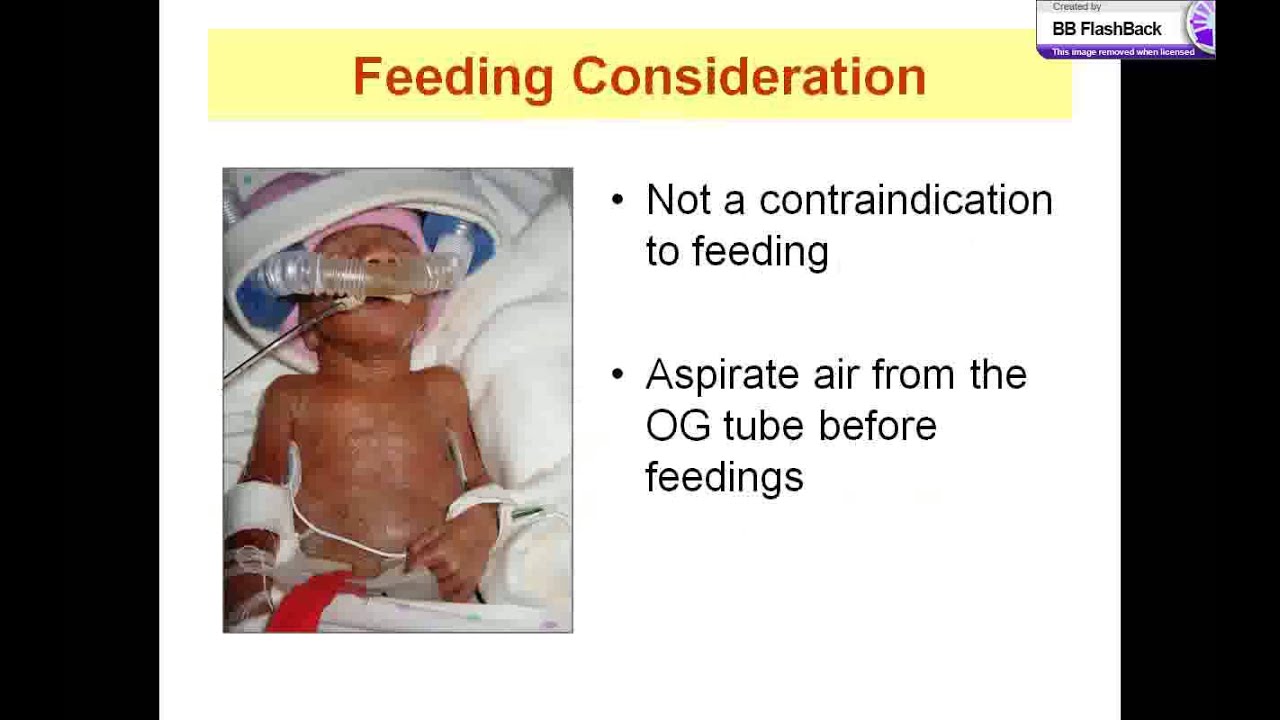 Dr Rishikesh Supportive care of a baby on CPAP - YouTube