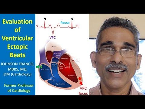 Evaluation of Ventricular Ectopic Beats - YouTube