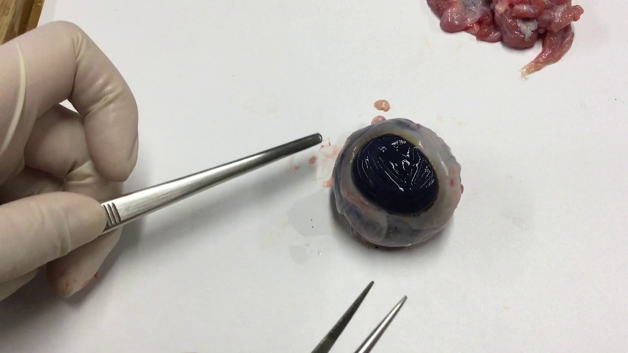 Ox eye dissection - YouTube