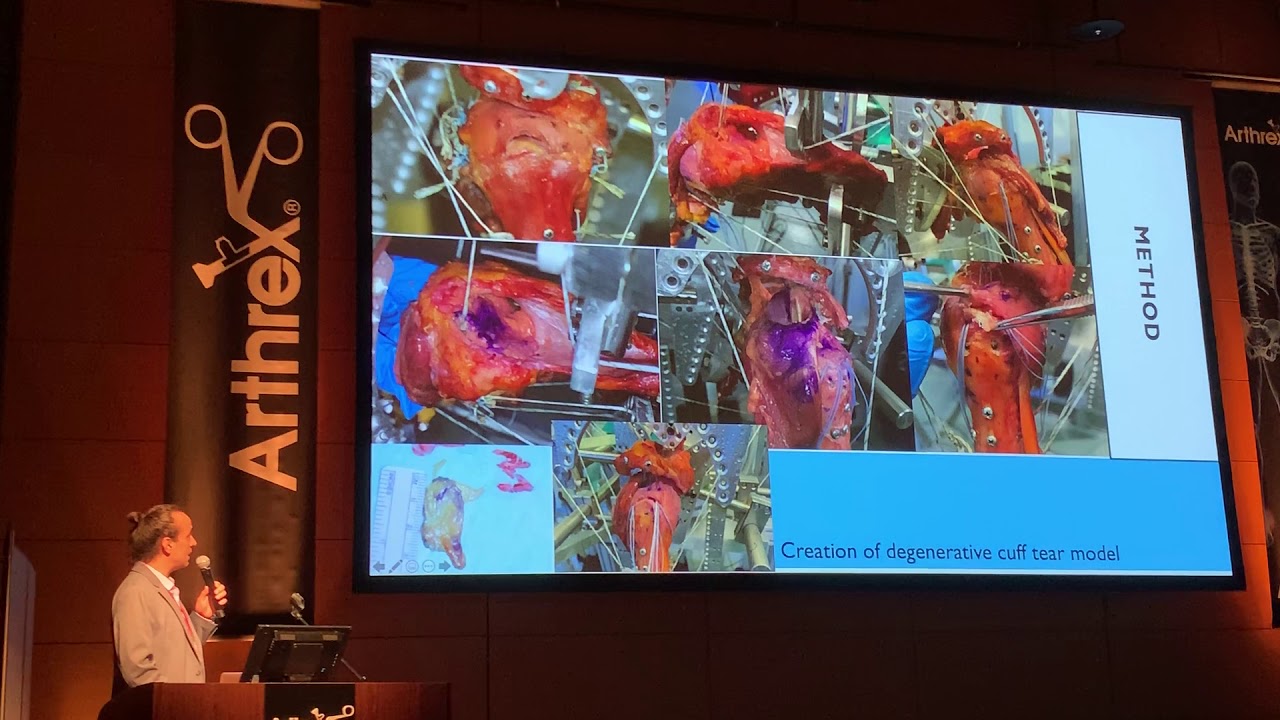 Superior Capsule Reconstruction Arthrex Conference 2020 Tokyo, Japan ...