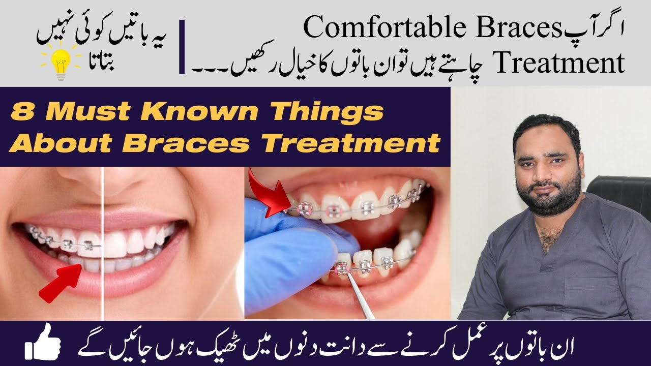 Orthodontist Braces Treatment Tips and Tricks || Watch This Before ...