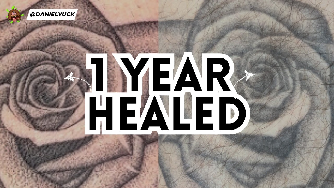 Stipple Shading Healed On Human Skin 1 Year - YouTube