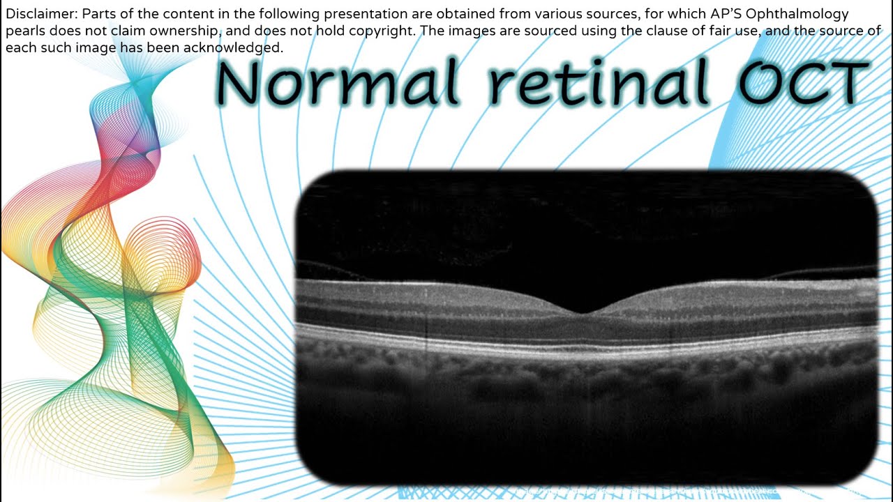 OCT 2 | Normal retinal OCT - YouTube