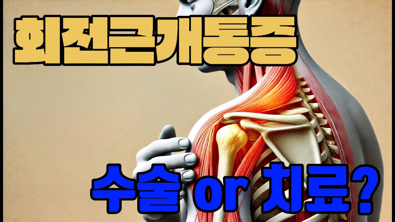 지속적인 회전근개통증! 수술할 것인가? 치료받을 것인가? - YouTube