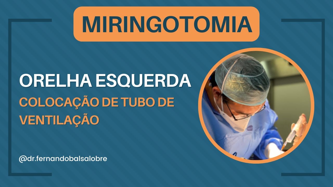 Miringotomia com colocação de tubo de ventilação em orelha esquerda ...