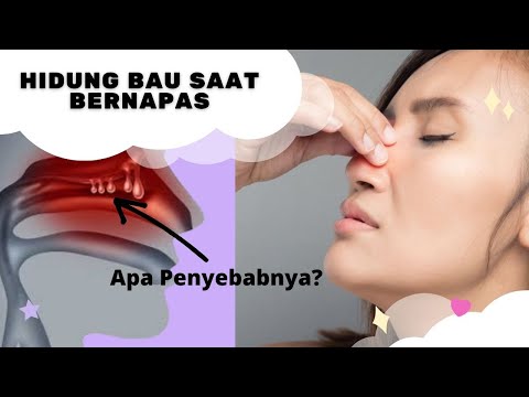 Kenapa Hidung Sering Bau saat Bernapas? Ketahui Penyebabnya Ini
