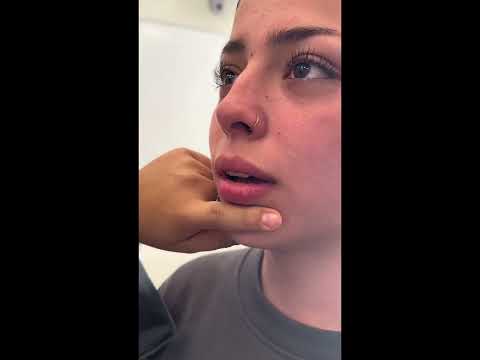 Reflejo rotuliano y mentoniano - YouTube