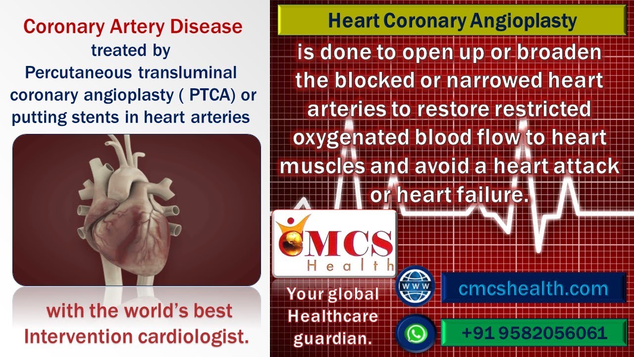 Ptca Featured Lecture: The Enlightened History Of PTCA: A