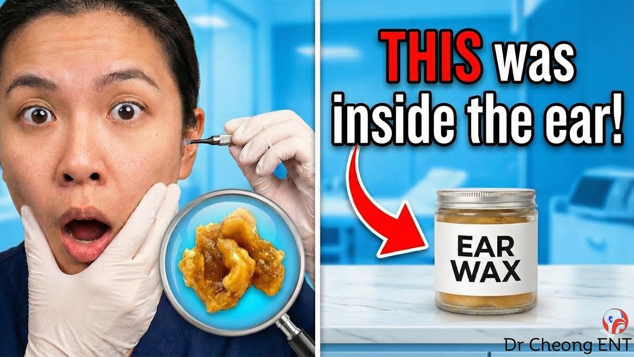 Microscope Ear Wax Removal by ENT Specialist | Safe & Precise - YouTube