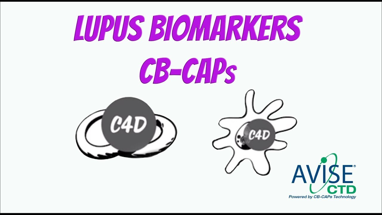 NEW Lupus Biomarkers - CB-CAPs Can Help Diagnose Lupus - YouTube