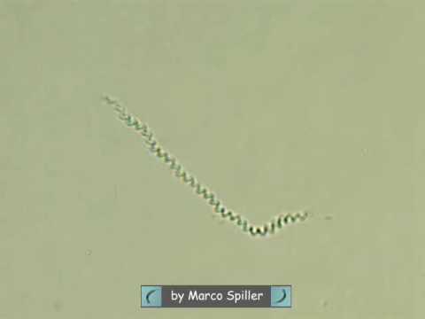 Spirochete - YouTube