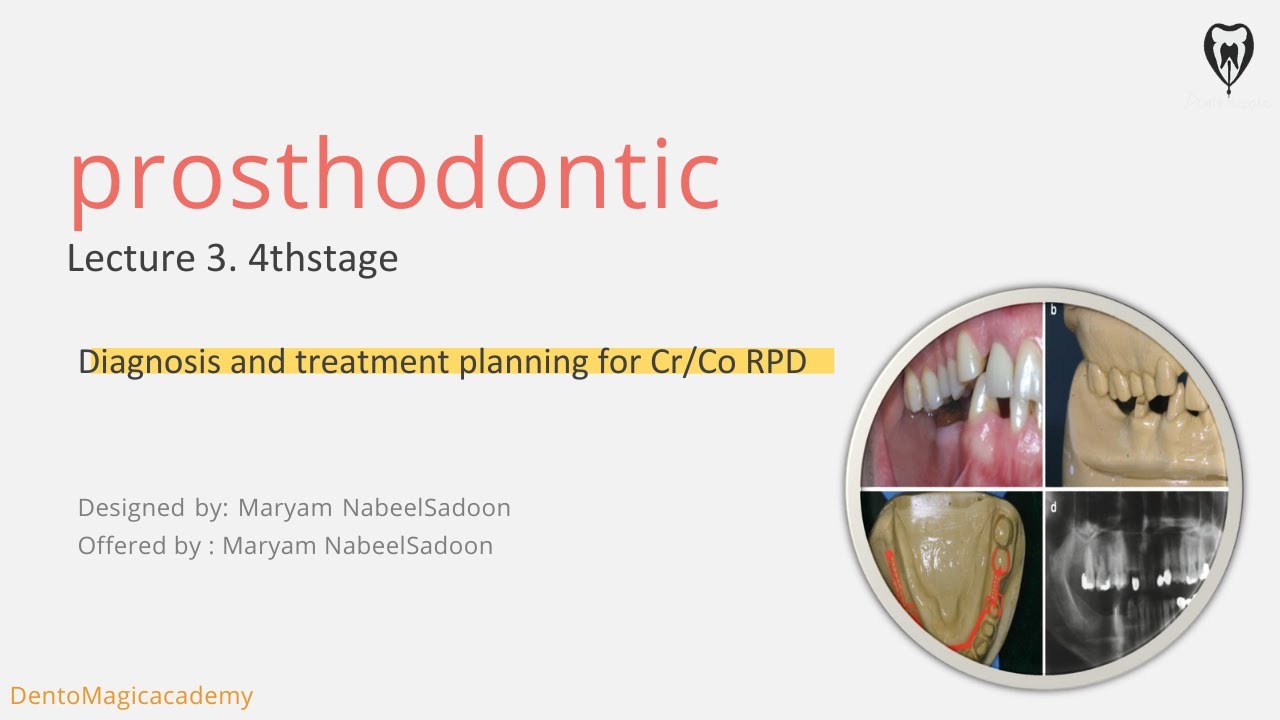 Prosthodontics 4th stage. lec3 (Diagnosis and treatment planning for Cr ...
