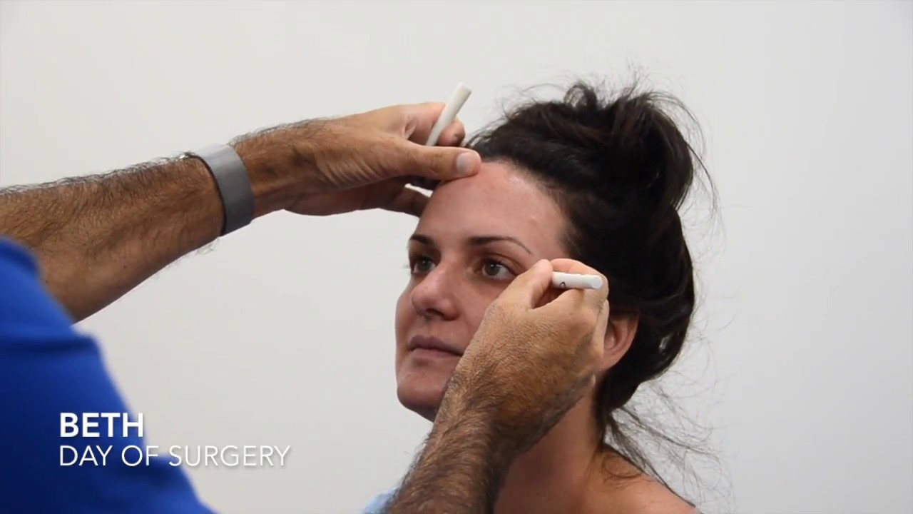 Surgery Experience with Dr. Parfitt - YouTube