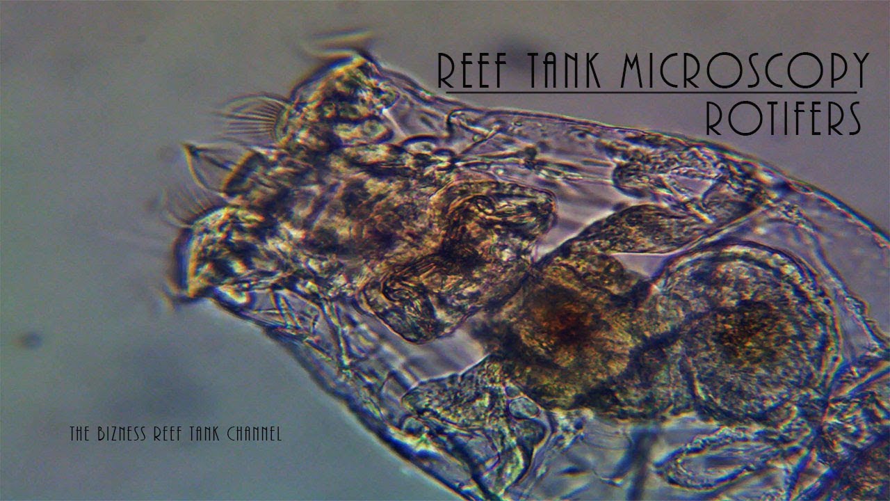 Reef Tank Microscopy - Rotifers - YouTube