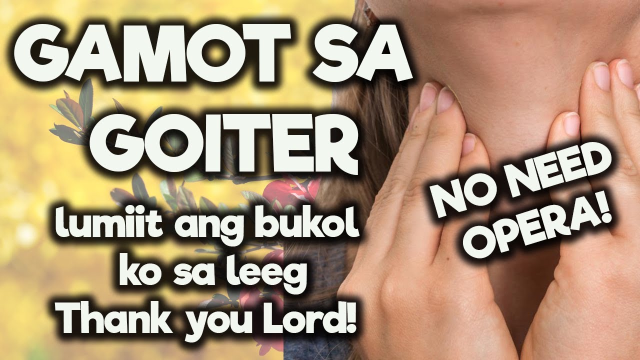 GAMOT SA GOITER / Lumiit ang bukol ko sa leeg! - YouTube