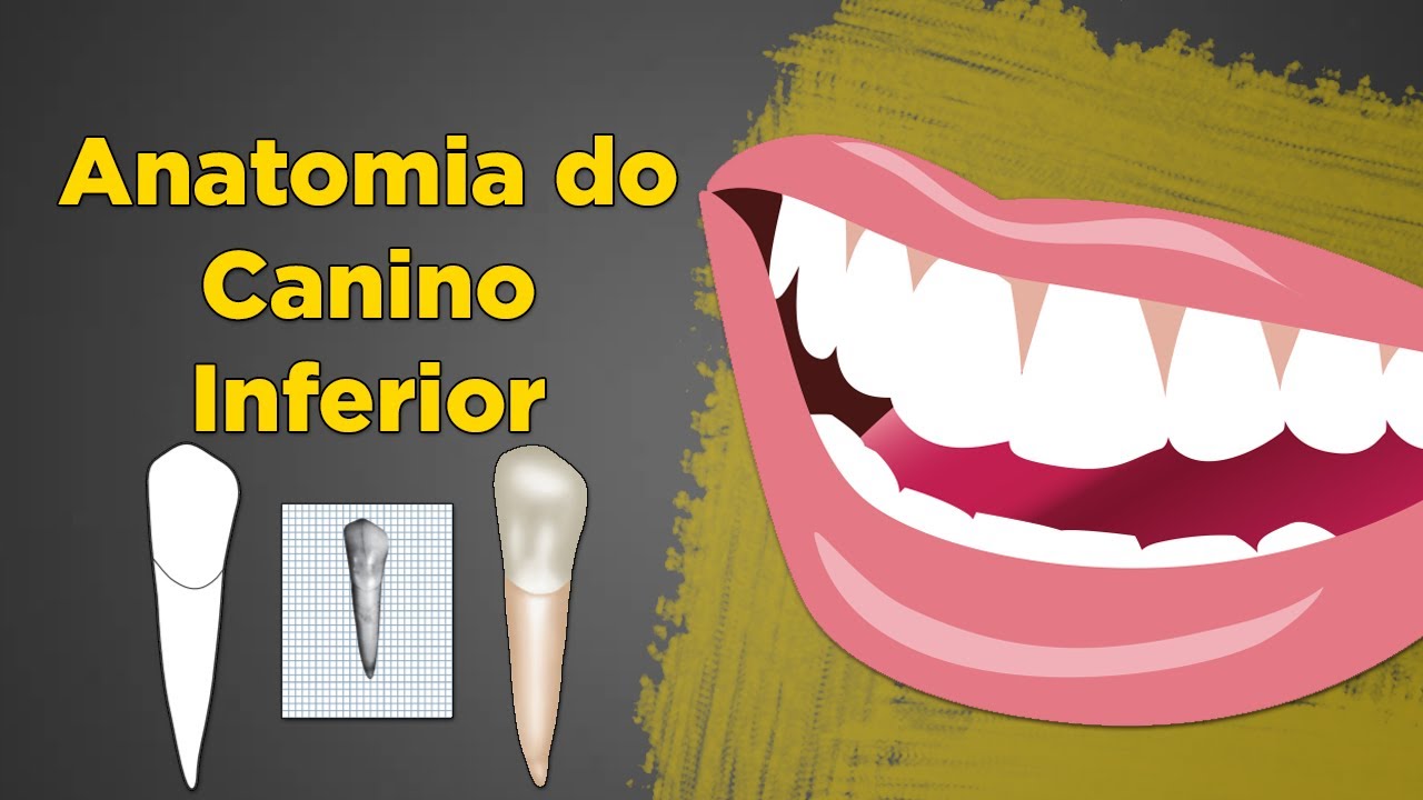 Anatomia do Canino Inferior - Resumo de Anatomia Dental - Dente 33 e 43 ...