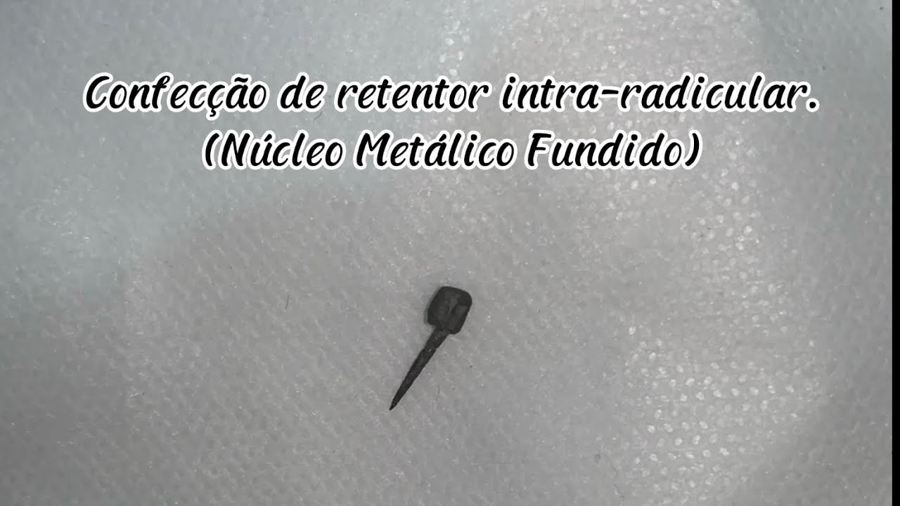 Retentor Intra-radicular (Núcleo Metálico Fundido) - YouTube