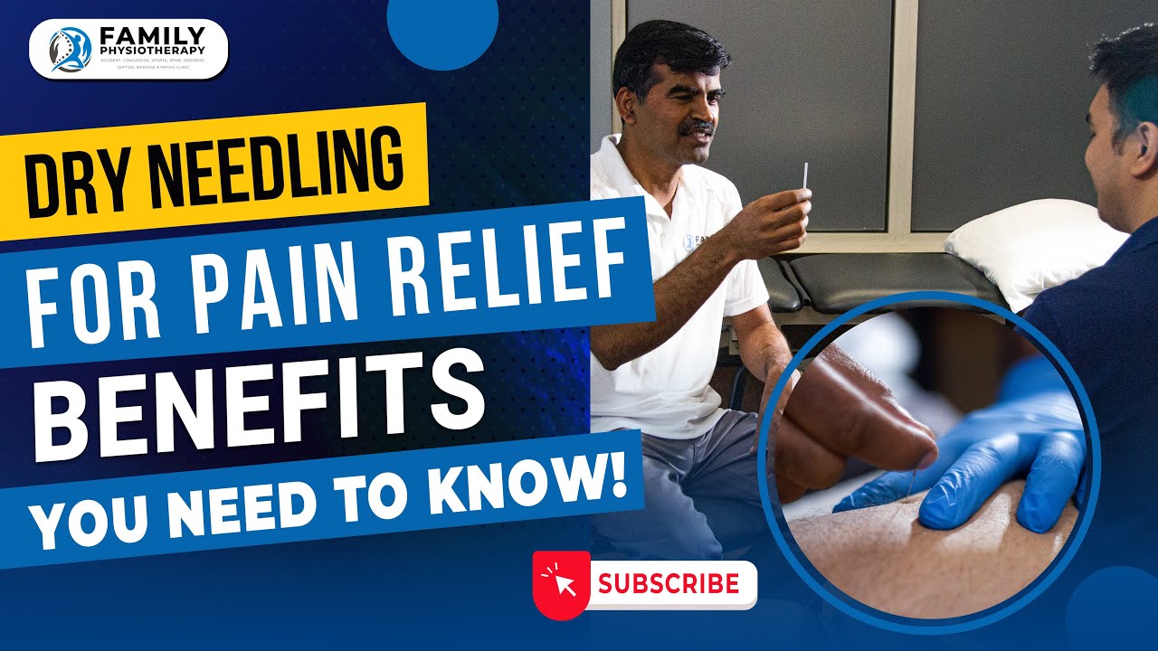 Dry Needling: A Powerful Tool for Pain Relief | Family Physiotherapy ...