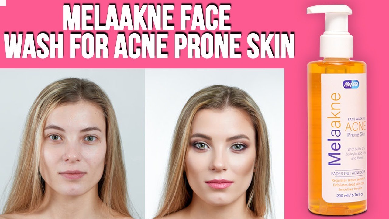 Melano-Pharma Melaakne Face Wash for Acne Prone Skin || Mak64 Wholesale ...