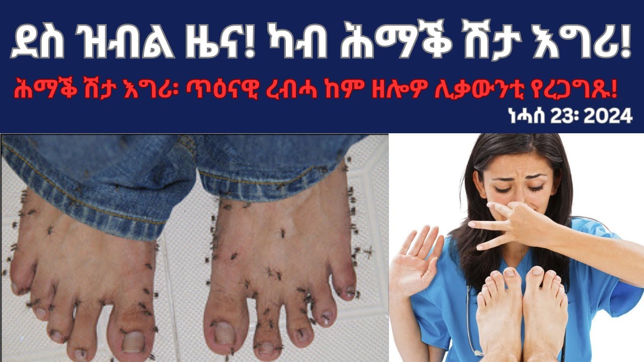 ሕማቕ ሽታ እግርን ጥዕናዊ ረብሓኡን! #Drsharonwoldu #health #eritreanfilm # ...