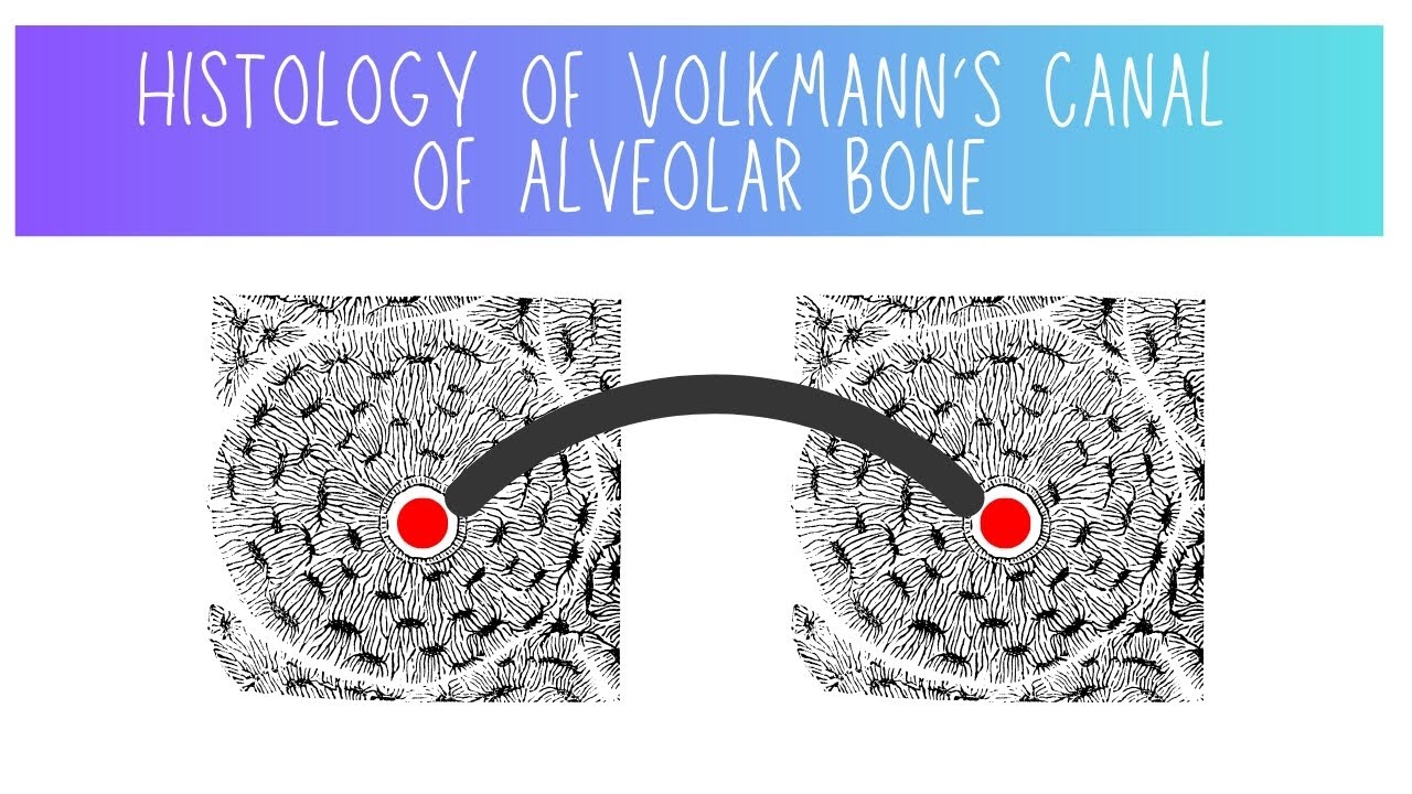 Histology of Volkmann's Canal of Alveolar Bone - Dentistry - YouTube