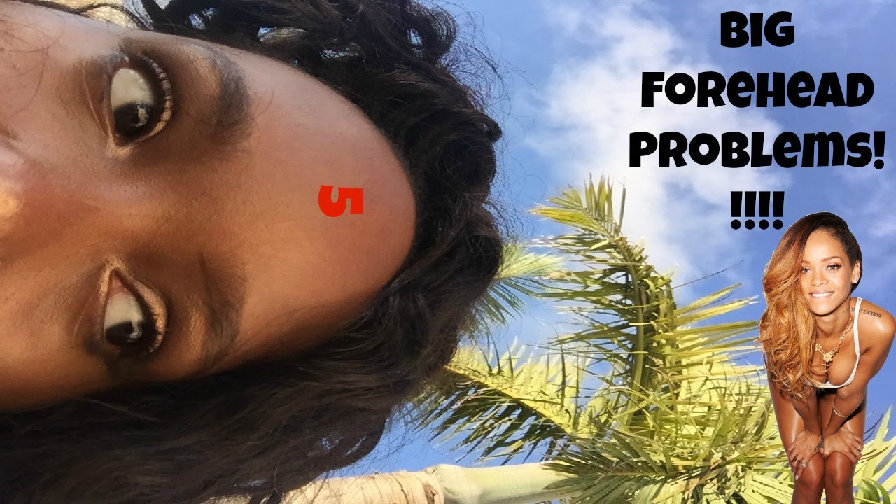 Big Forehead Problems!!!/ Rant// Whitney Riley - YouTube