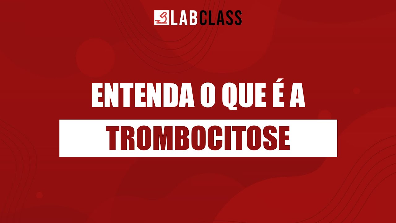 Entenda o que é a trombocitose - YouTube