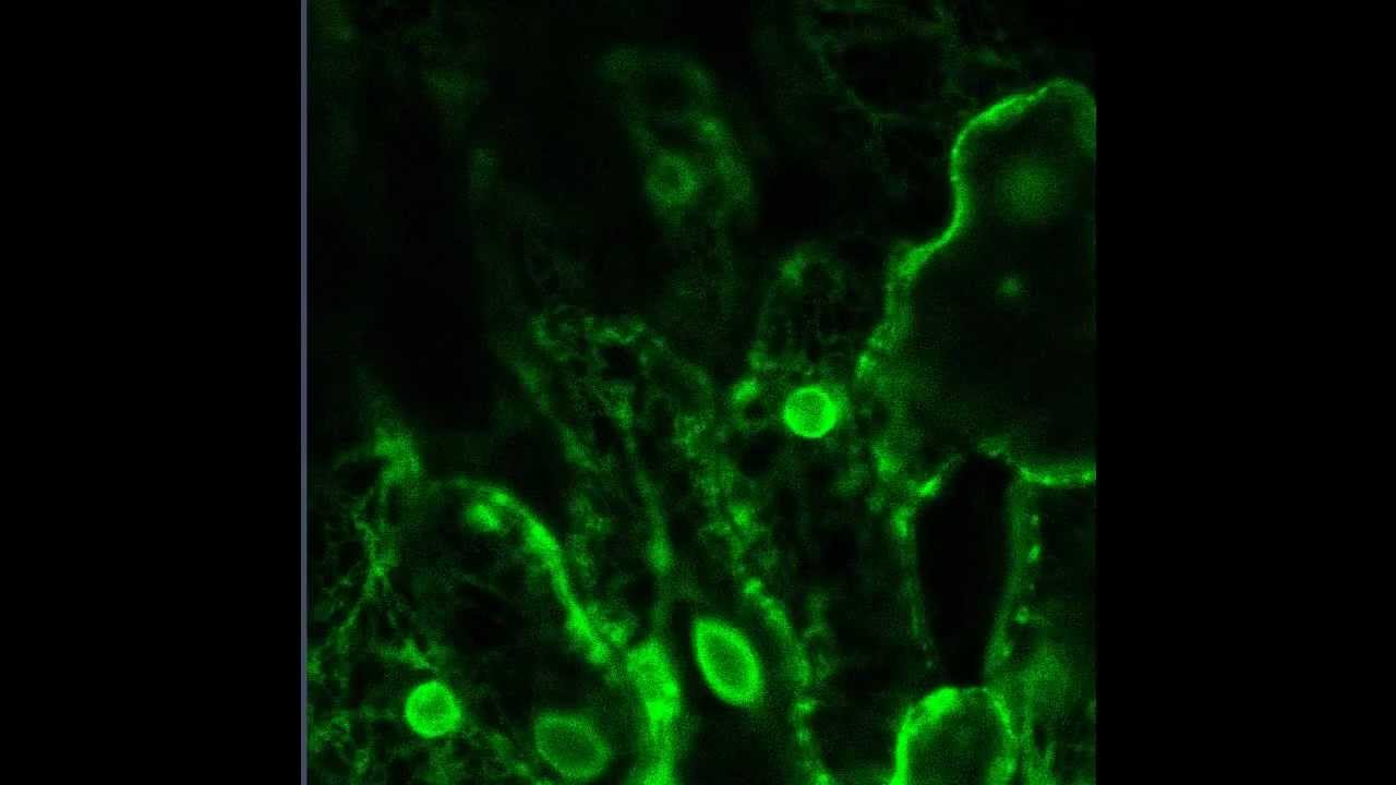The Dynamic Endoplasmic Reticulum Youtube