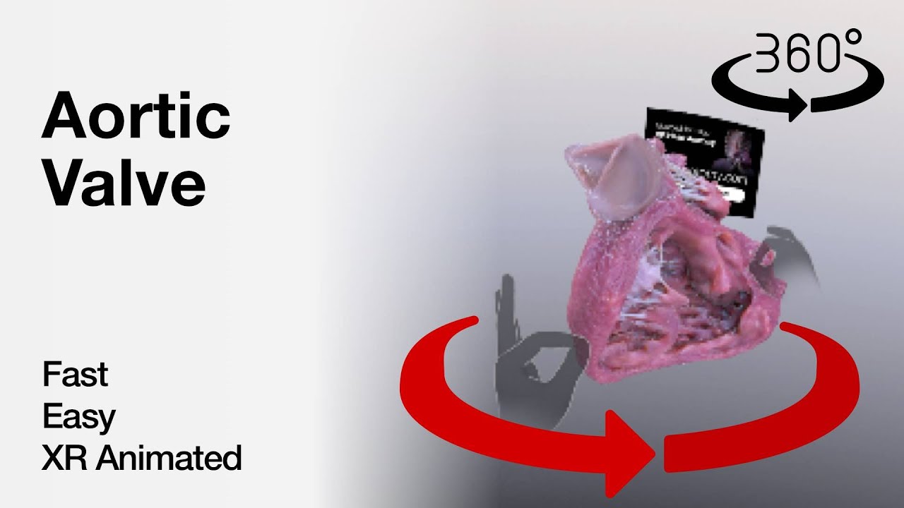 360 video - Aortic Valve - Explained in Mixed Reality - YouTube