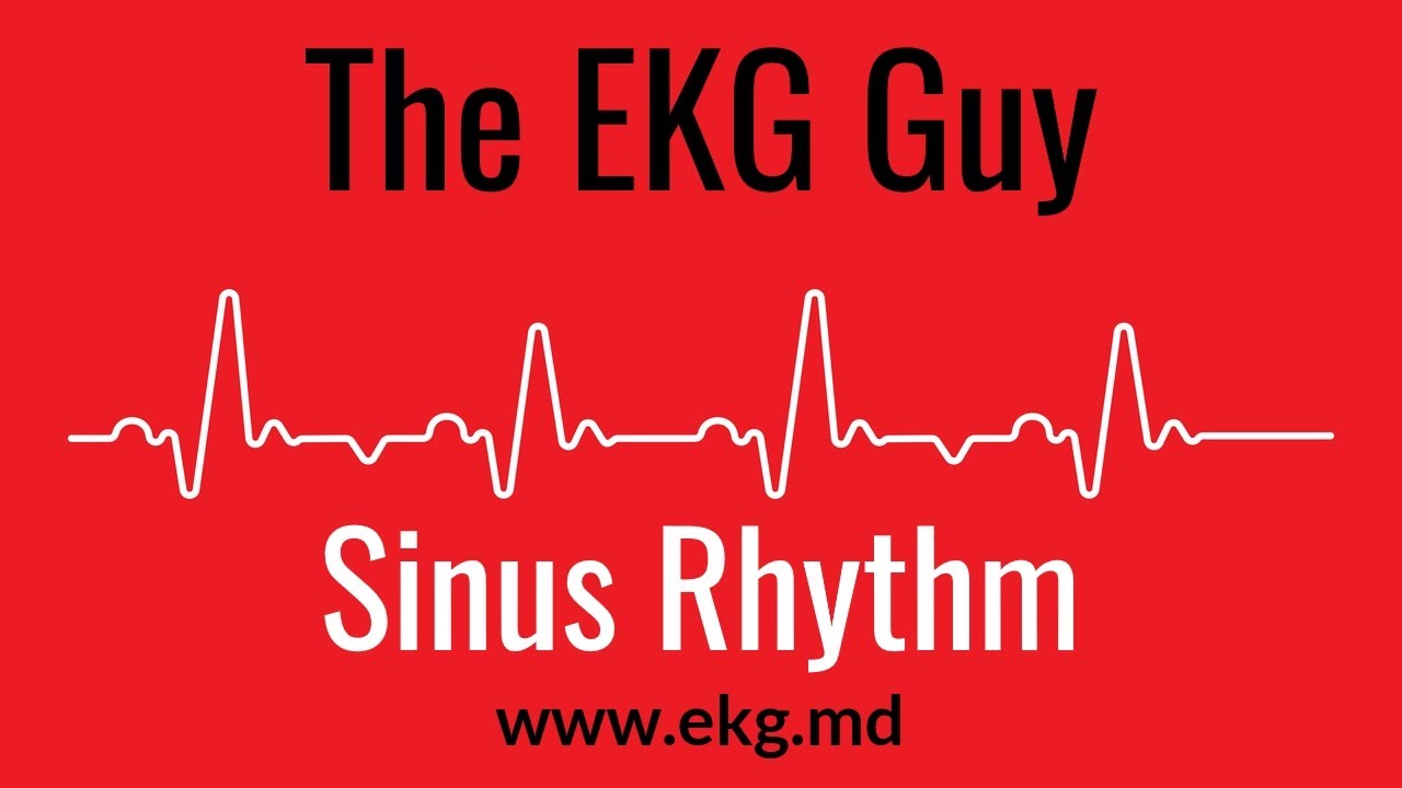 Sinus Rhythm EKG l The EKG Guy - www.ekg.md - YouTube