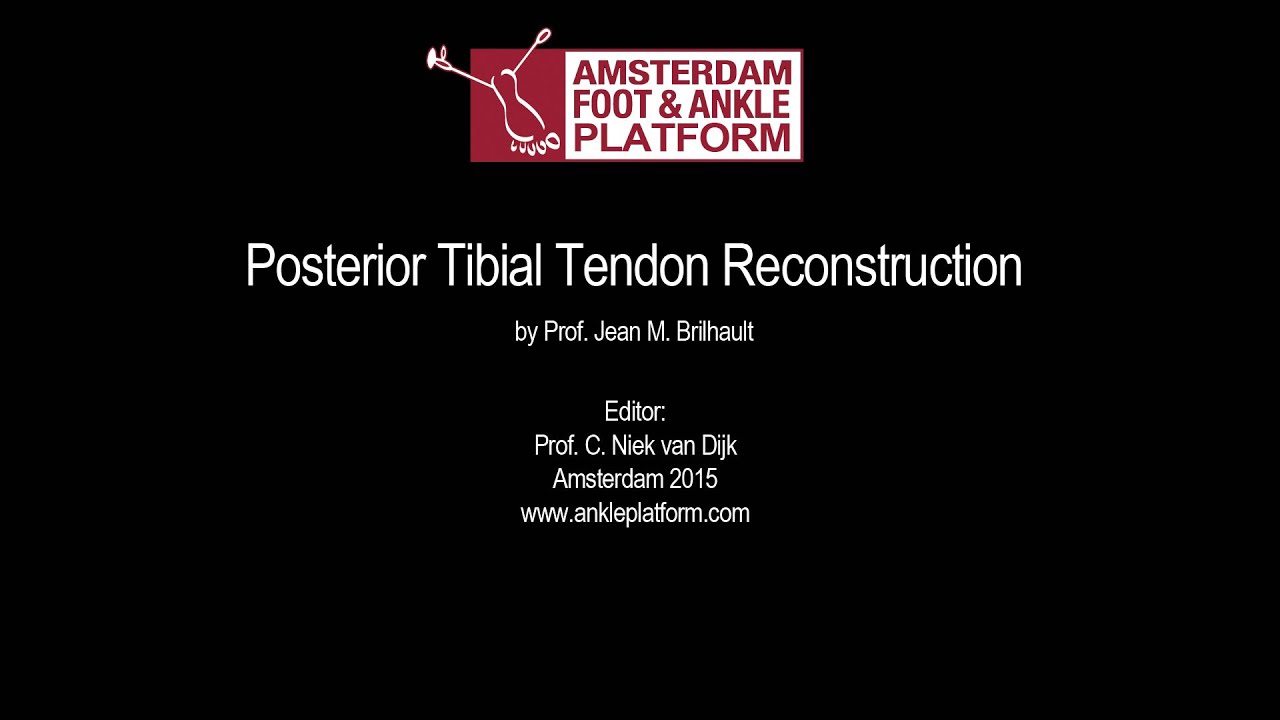 Posterior Tibial Tendon Transfer - YouTube