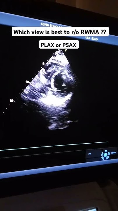 RWMA in ECHO... #trap #remix #like #trend #shorts #explore #motivation #lucknow #beats #song # ...