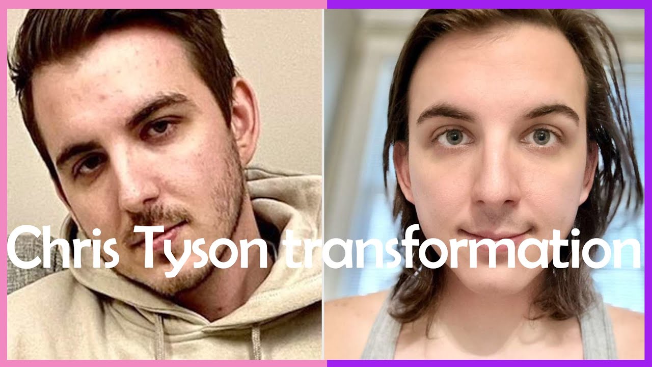 Chris Tyson from Mrbeast started Hormone Therapy | H3H3 Creations - YouTube