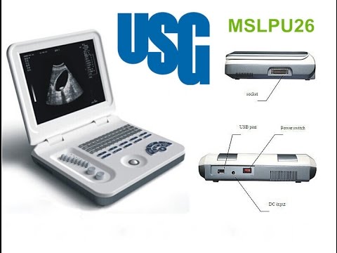 cheapest ultrasound machine / portable fluoroscopy machine MSLPU26 ...