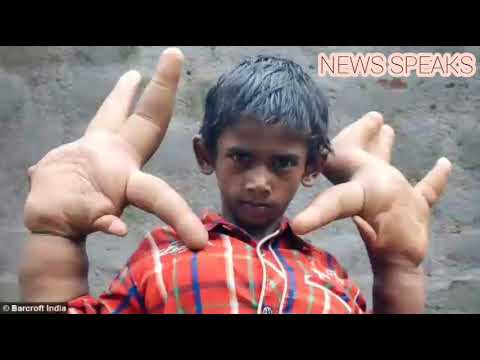 WORLD LONGEST BODY PARTS IN THE WORLD - YouTube