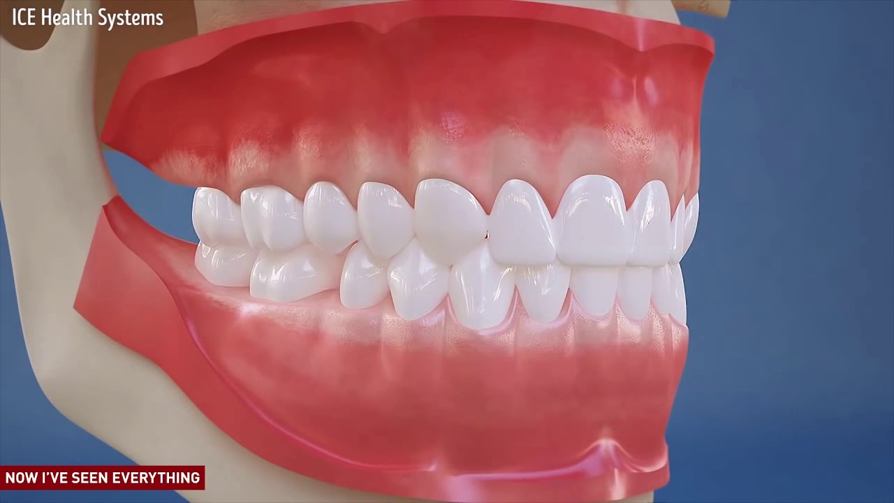 dentaris - YouTube