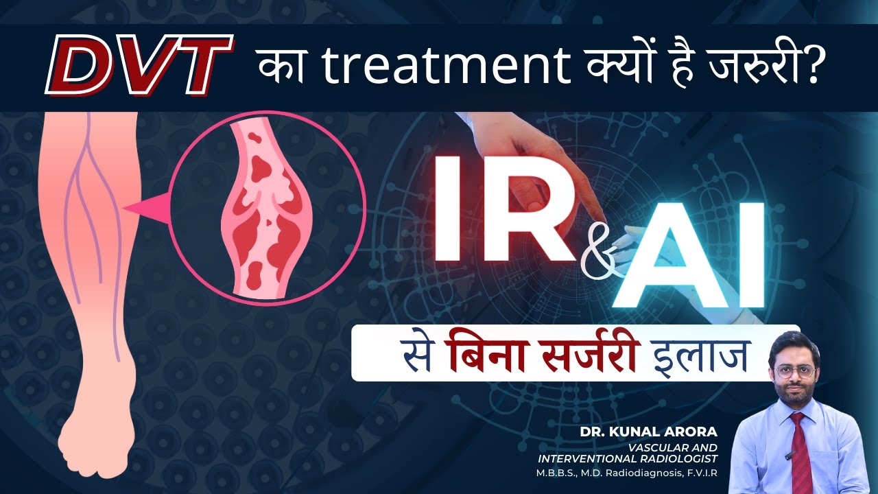 Treatment of Deep Vein Thrombosis (DVT) with interventional radiology ...
