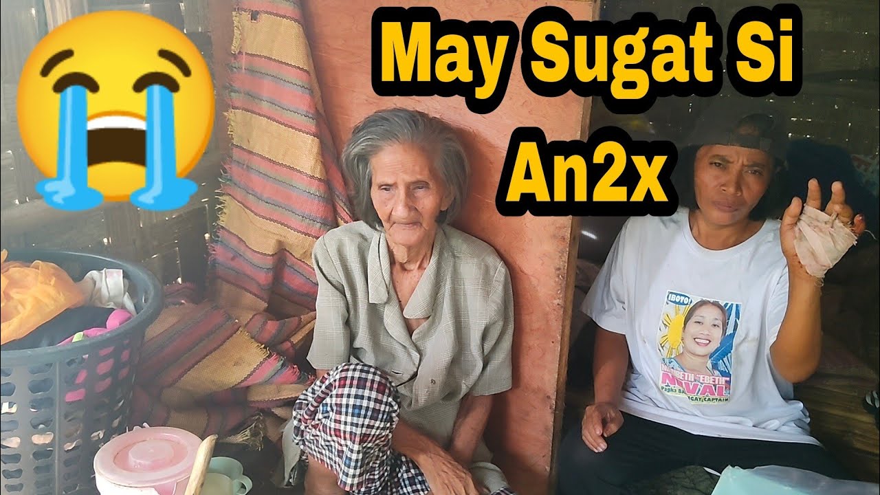 May Malaking Sugat Si An2x - YouTube
