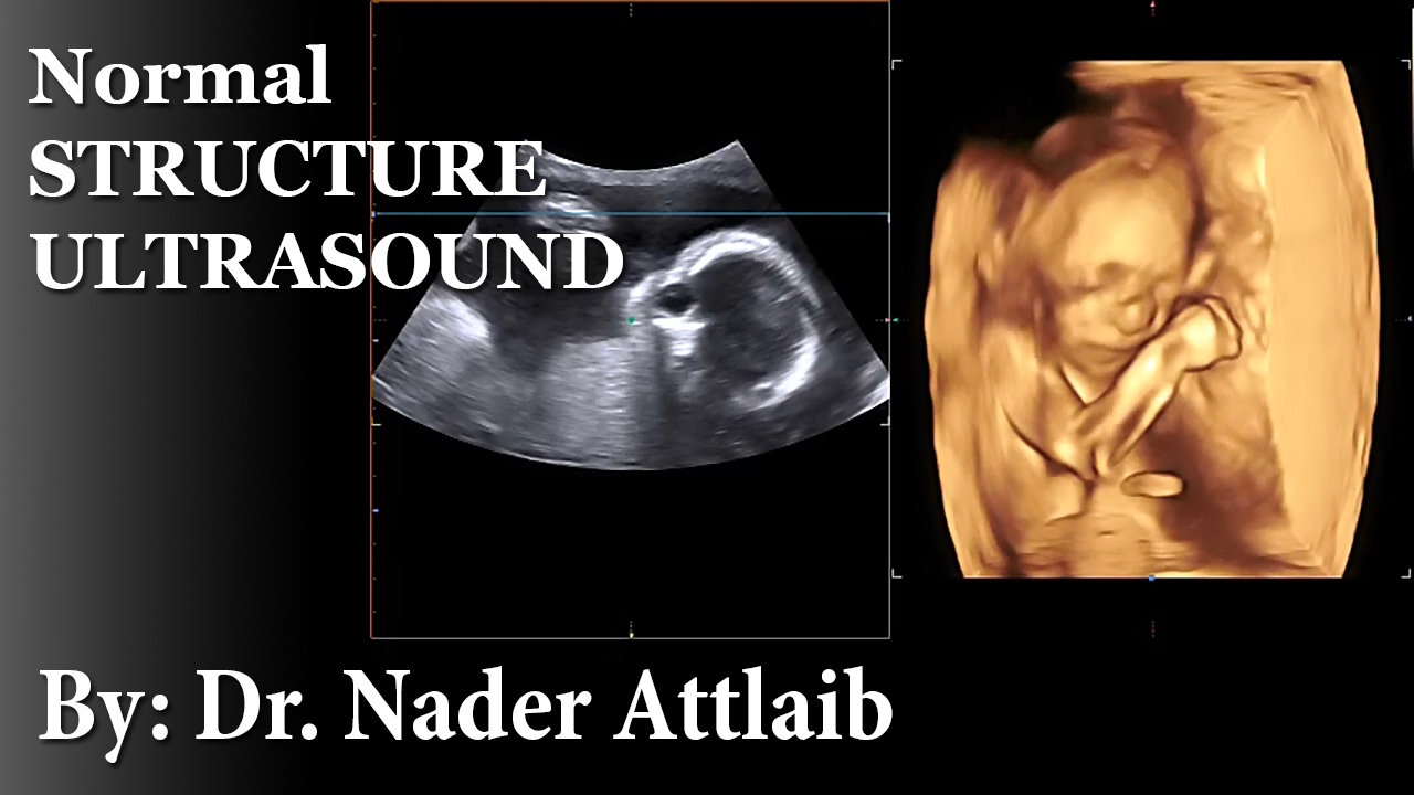NORMAL STRUCTURE ULTRASOUND - YouTube