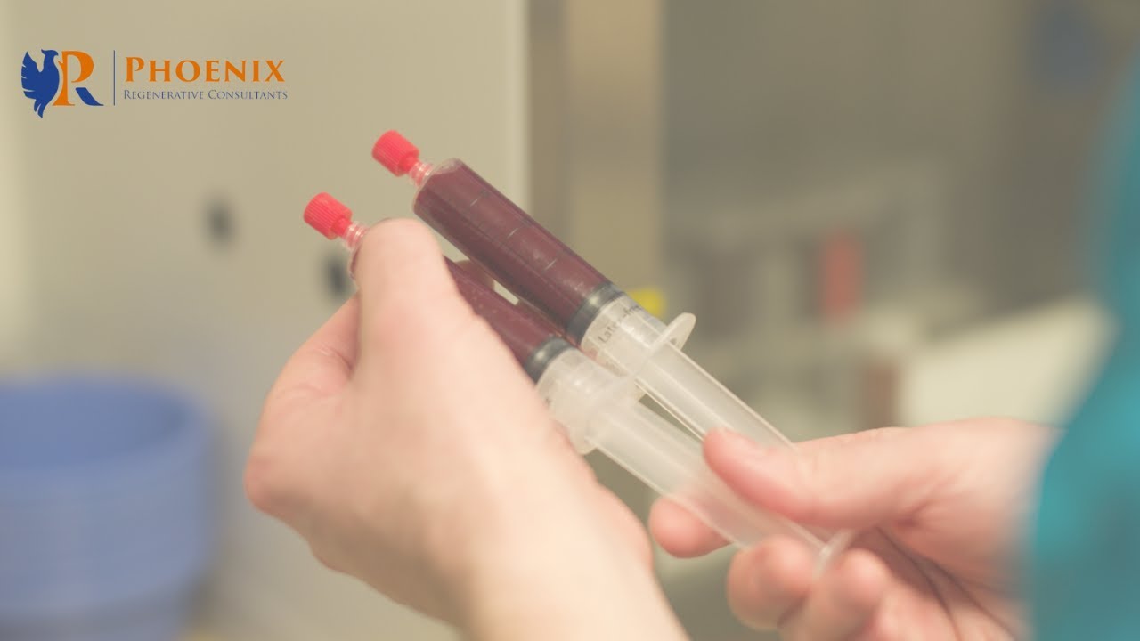 PRP - Learn how to " Do-it-yourself" and make PRP for only €17 per ...