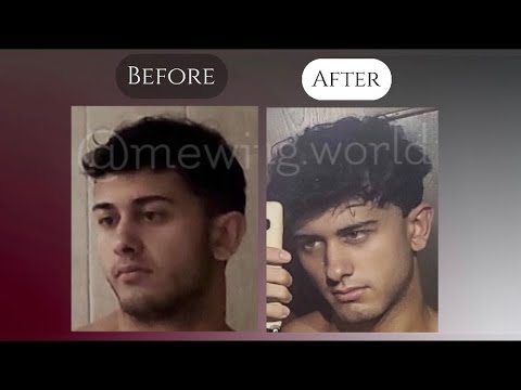 HOW TO GET HIGHER CHEEKBONES NATURALLY! 🔥🔥 - YouTube