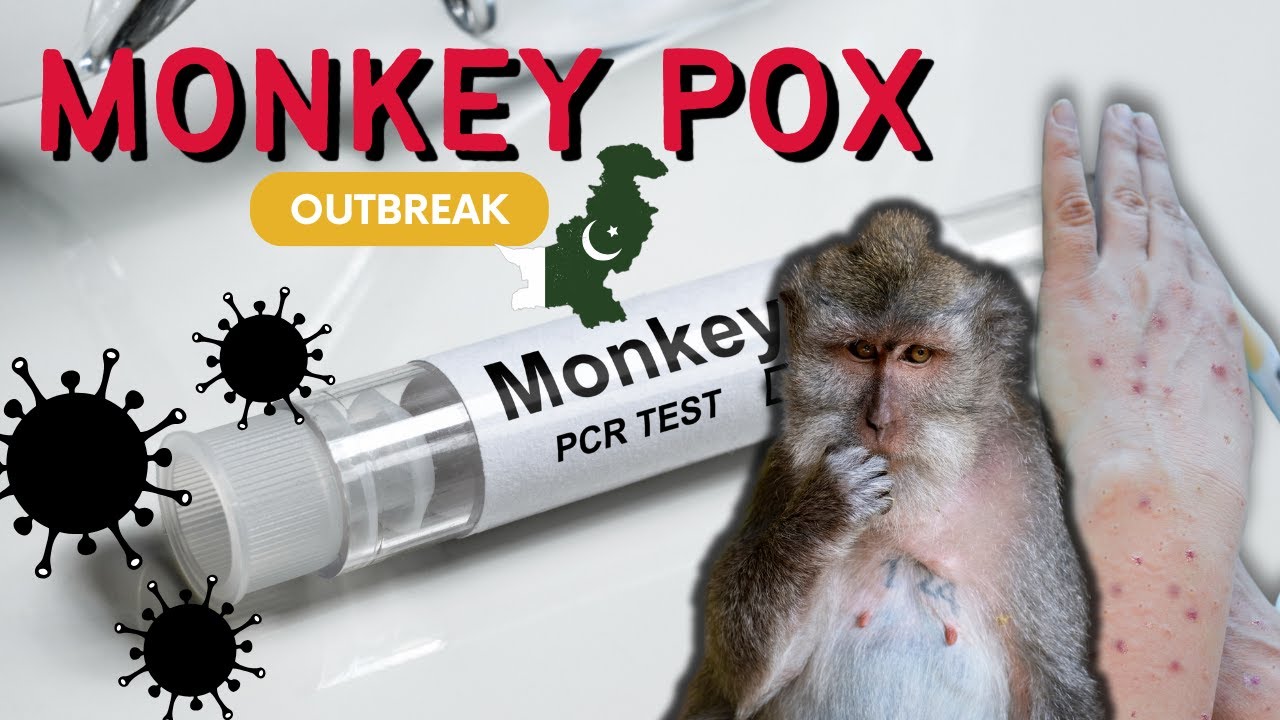 M-POX in 2 minutes| Monkey Pox or new COVID-19?|| EP#5 - YouTube
