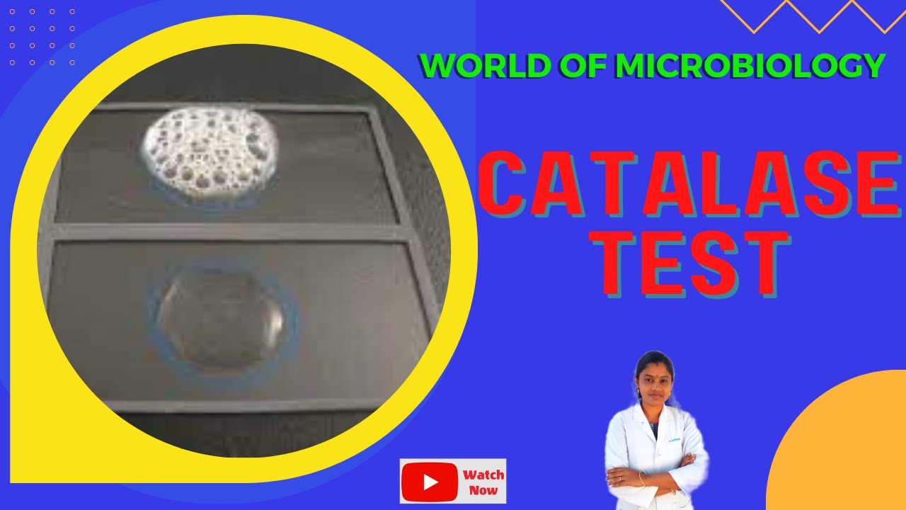 Catalase Test ( Tamil) || Identification of Bacteria by Biochemical ...