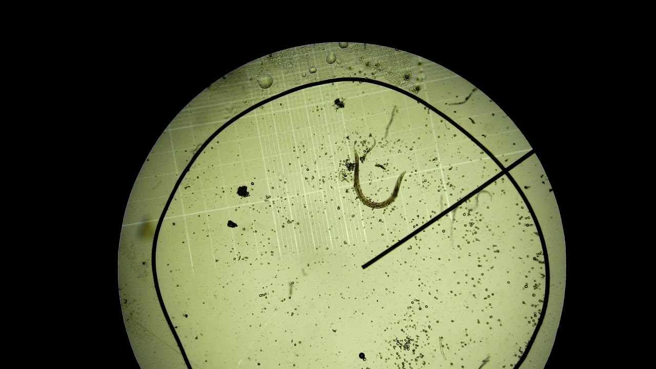microworm in Microscope 4X หนอนจิ๋วในกล้องจุลทรรน์กำลังขยาย40เท่า - YouTube